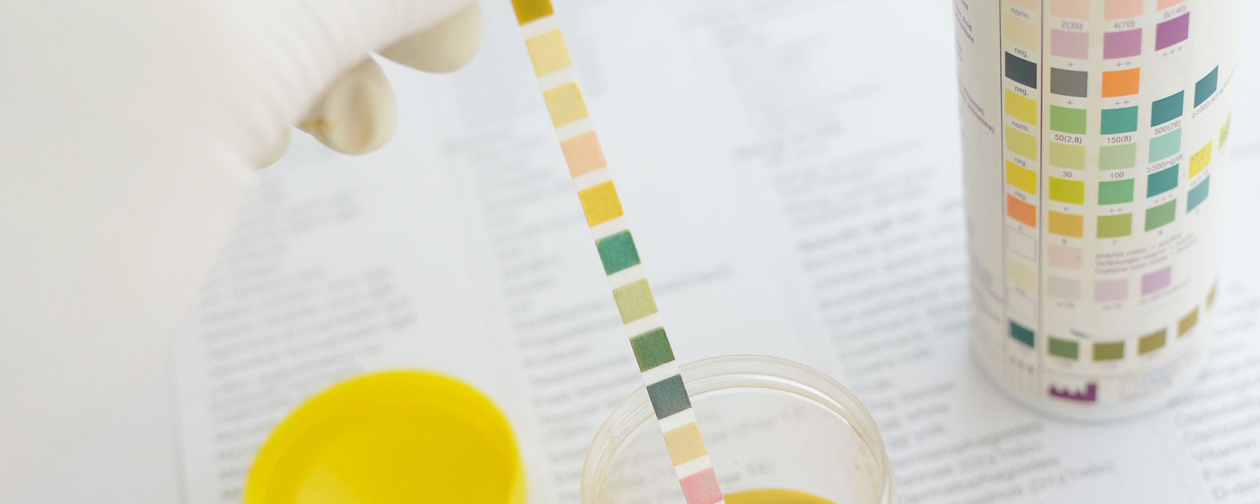 Urine Analysis - Paddington Clinic Brisbane